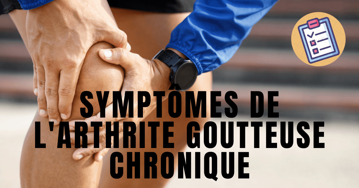 Arthrite goutteuse chronique - Ce que vous devez savoir